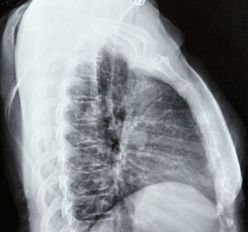 Breathe Into Your Back – The Deva Method